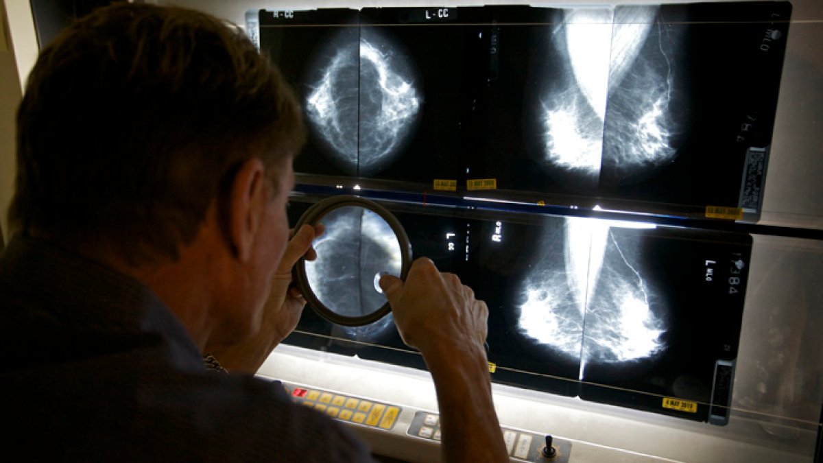 New Breast Cancer Guidelines Say to Start Screenings at Age 40, Instead ...