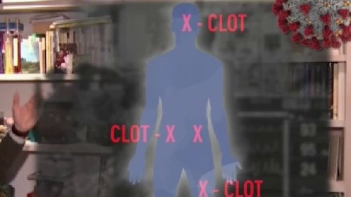 I-Team: Blood Clots Closely Associated with COVID-19 Deaths, Research ...