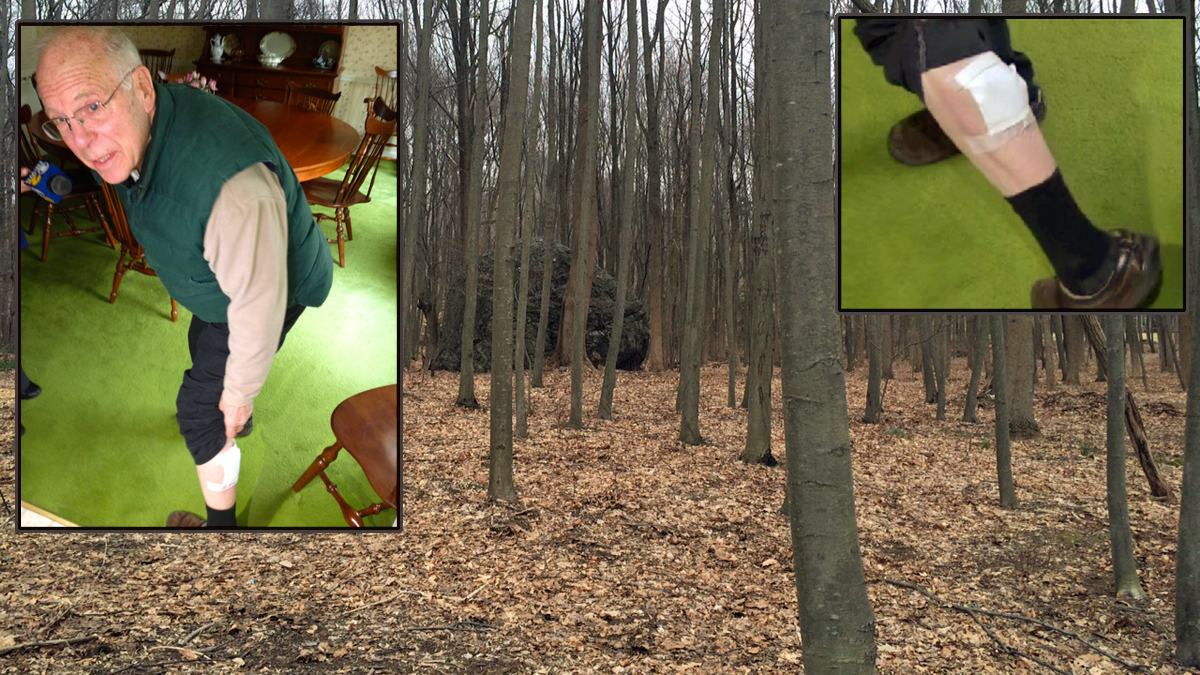 Coyote That Attacked New Jersey Man Working in Yard Was Rabid ...