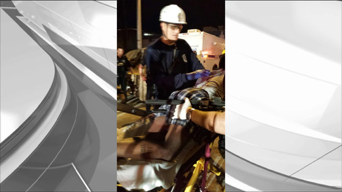 Crews Rescue Man Impaled on Fence in Ft. Lauderdale – NBC 6 South Florida