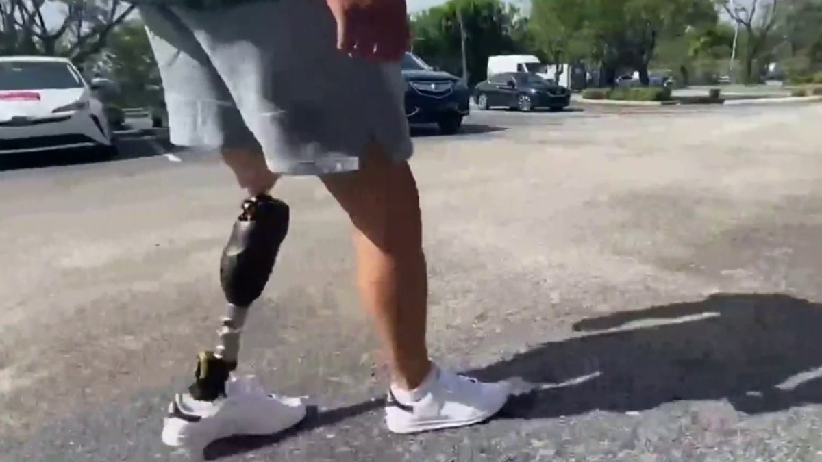 New Bionic Knee Opens Up Microprocessor Tech for Some Amputees – NBC 6 ...