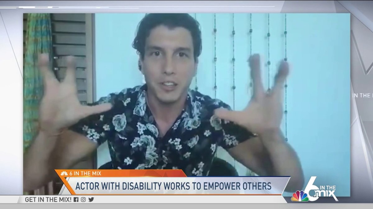 Cool Hands: Actor With Disability, Alex Barone, Works To Empower Others ...