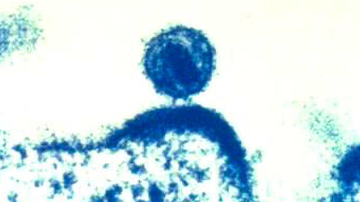 Scientists Find Unrecognized Virulent HIV Variant: ‘Not a Public Health ...