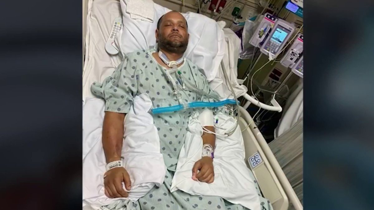 Davie Father Fights For His Life After Being Shot – NBC 6 South Florida