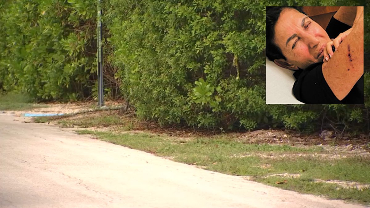 Woman Attacked on Haulover Beach – NBC 6 South Florida