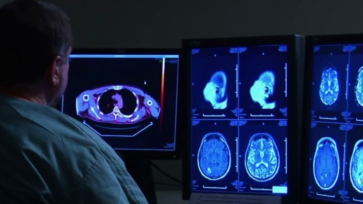 FIU Researchers Develop Algorithm That Can Diagnose Strokes With 84% ... FIU Researchers Develop Algorithm That Can Diagnose Strokes With 84% ...