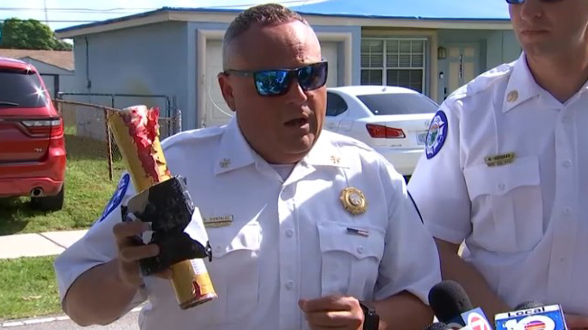 13-year-old boy burns his face, loses part of his fingers at Fourth of ...
