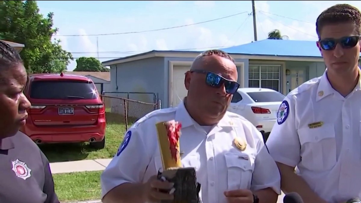 Lauderhill Teen Has 5 Fingers Partially Amputated After Fireworks ...