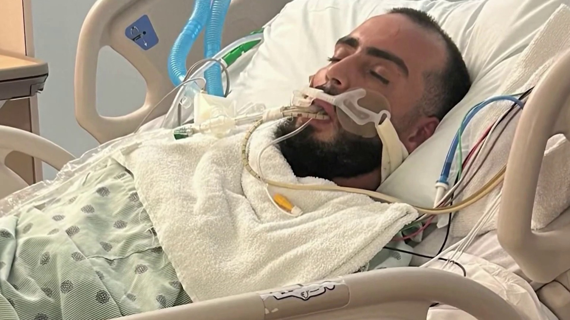 Man remains in coma weeks after he was shoved during night out in Fort ...