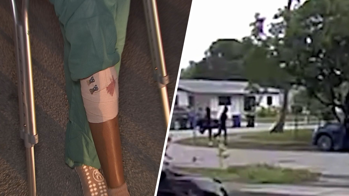 Fort Lauderdale shooting: Teen speaks out after grazed by bullet – NBC ...