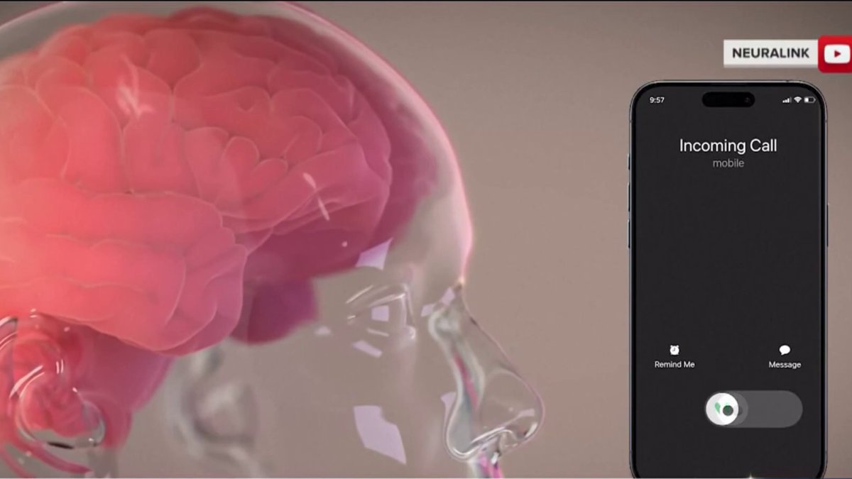 Elon Musk says his startup Neuralink has implanted a brain chip in its ...
