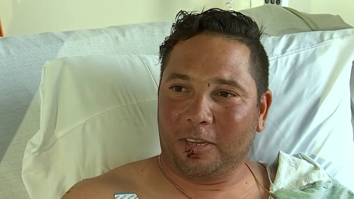 Shark bite victim speaks out from hospital bed – NBC 6 South Florida