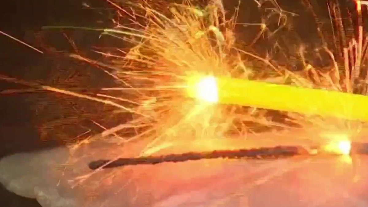 6-year-old boy loses hand in fireworks accident – NBC 6 South Florida