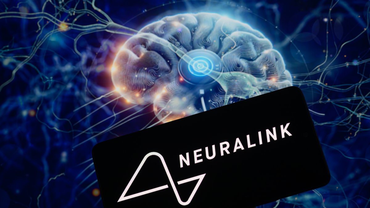 University of Miami selected site for Neuralink PRIME study – NBC 6 South Florida