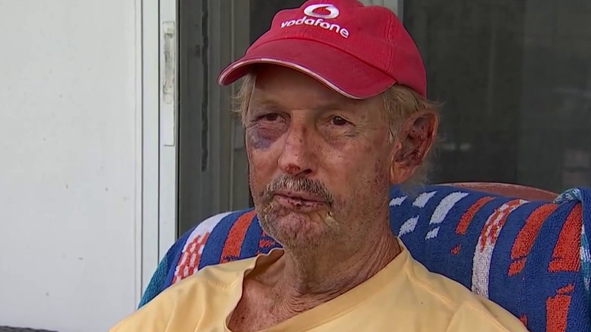 Man, 73, recounts home invasion and brutal attack in Fort Lauderdale ...