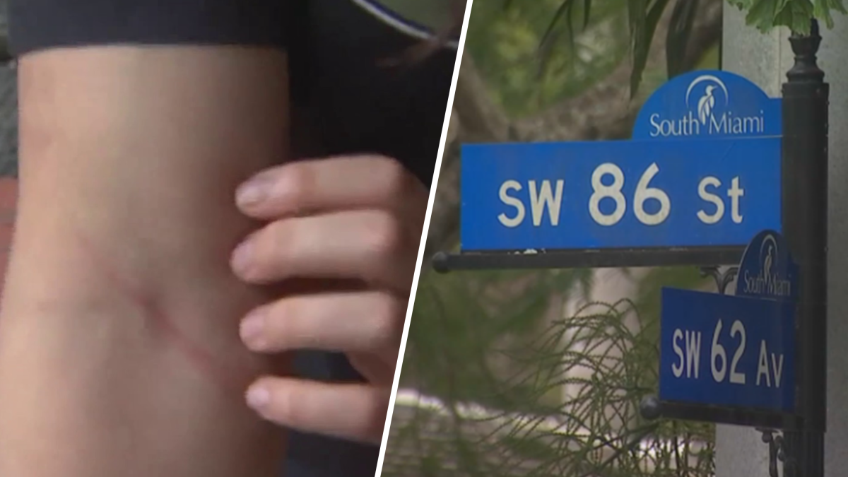 Teen recalls fighting off attempted kidnapper in South Miami – NBC 6 ...