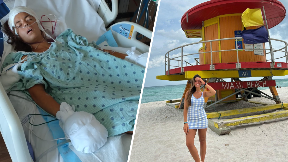 Miami tourist recovering after hit-and-run leaves her in critical ...