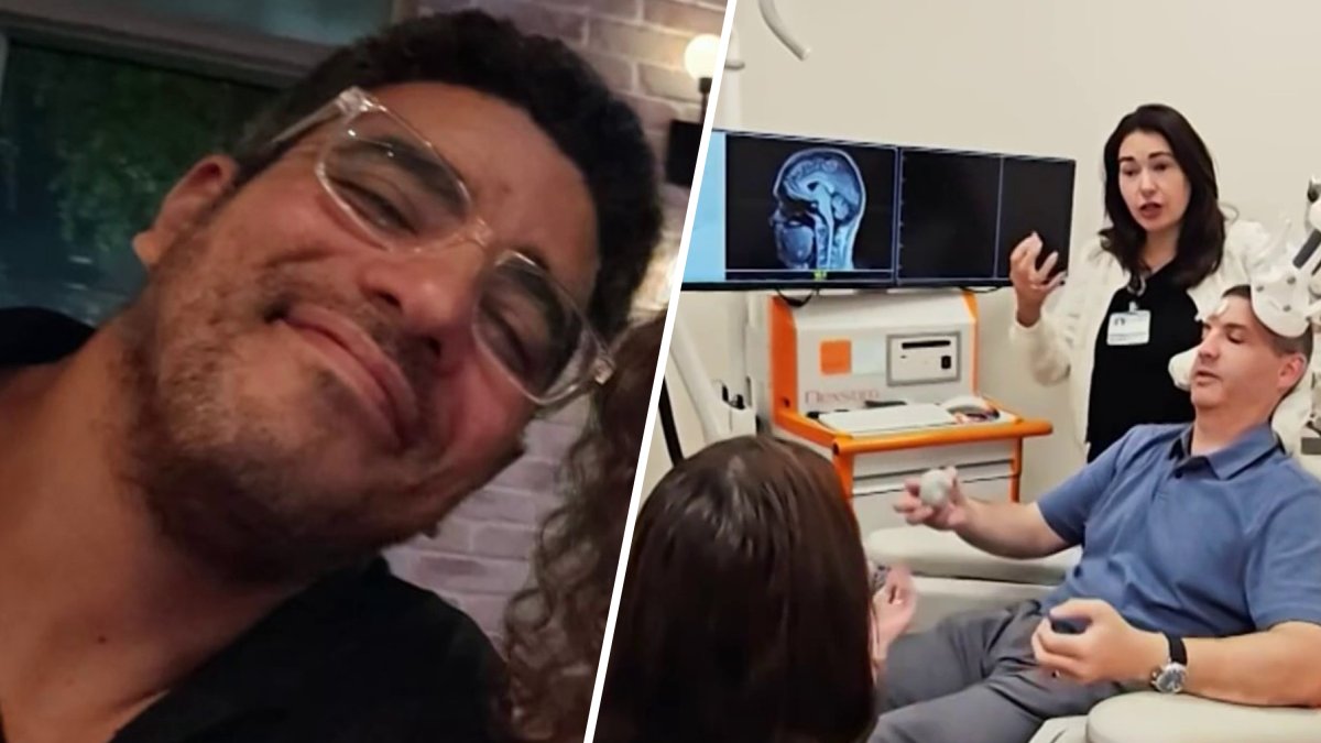 How transcranial magnetic stimulation, or TMS, works – NBC 6 South Florida