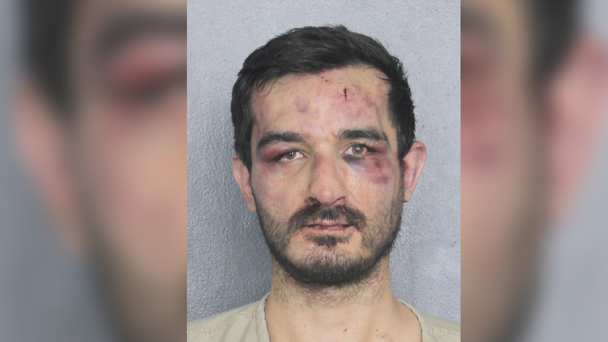 Suspect left badly bruised after allegedly breaking into Wilton Manors ...