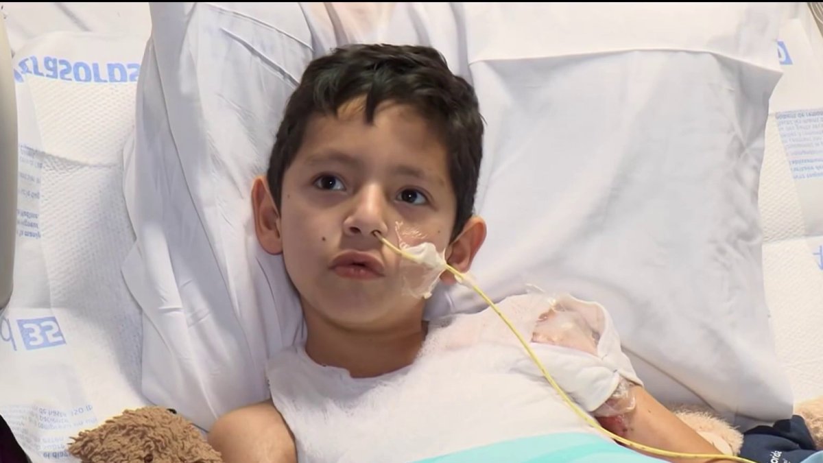 South Florida boy severely burned by sparklers on NYE set to leave ...